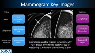 Breast-Tumor-Board-FINAL.pdf for imaging students | PPT