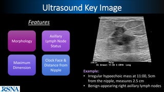 Breast-Tumor-Board-FINAL.pdf for imaging students | PDF