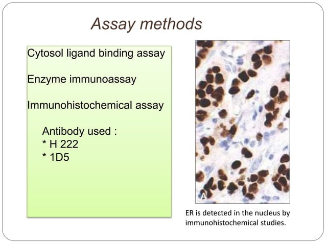 Immunohistochemistry of breast lesions(IHC) | PPTX | Cancer | Diseases and Conditions