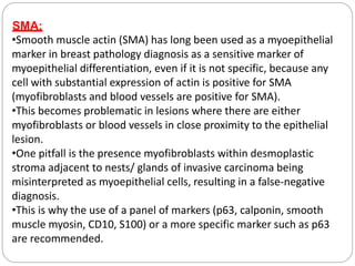 Immunohistochemistry of breast lesions(IHC) | PPTX