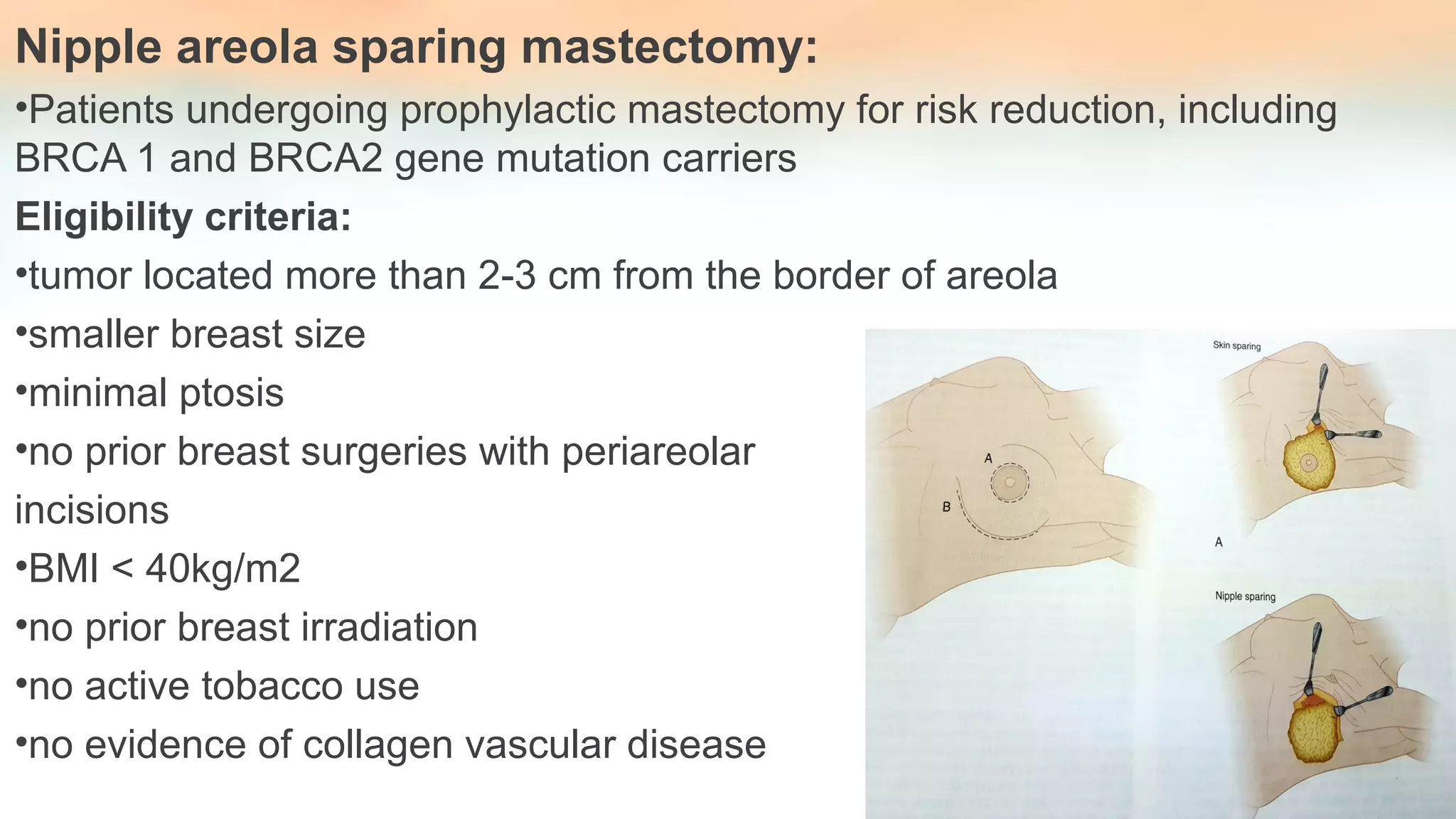 surgeries for Breast carcinoma | PPT