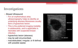 Breast Abscess | PPTX