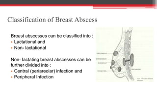 Breast Abscess | PPT