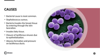 Breast Abscess; Causes to Managment.pptx