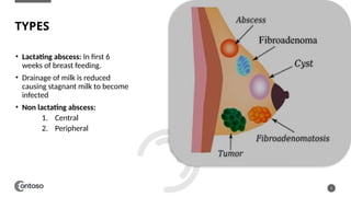 Breast Abscess; Causes to Managment.pptx