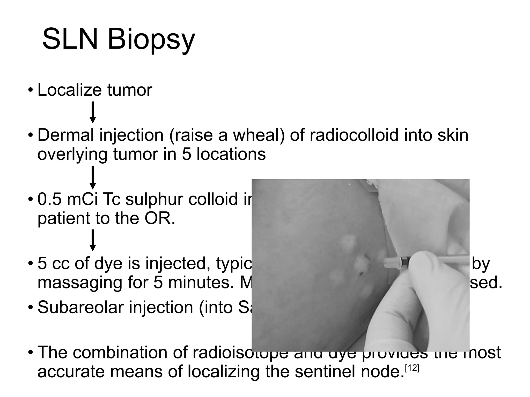 Breast anatomy | PDF