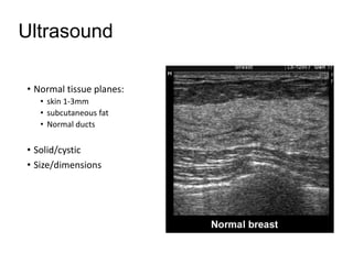 Breast anatomy | PDF