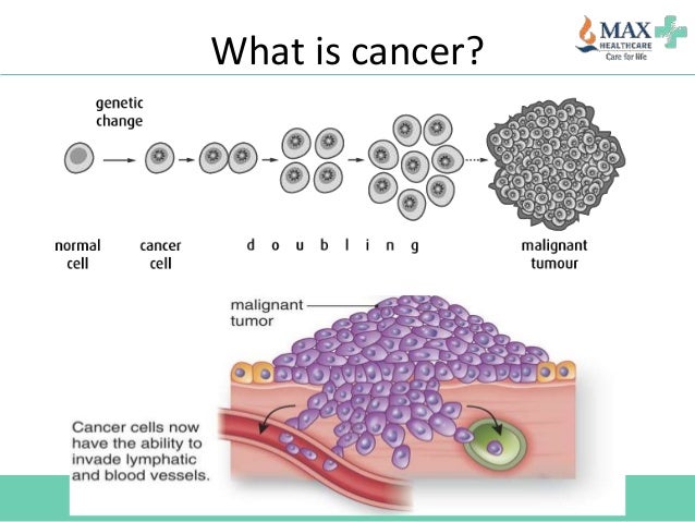 Breast and cervical cancer awareness