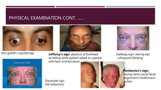 Breast and thyroid examination | PPTX