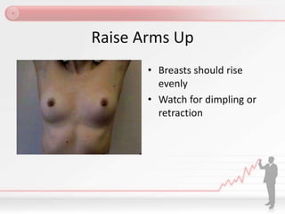 Breast, axillae, abdomen examination | PPTX