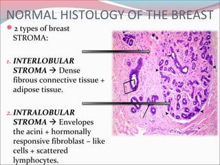 Breastbenigndisorderspathology 110914231905-phpapp01 | PPT