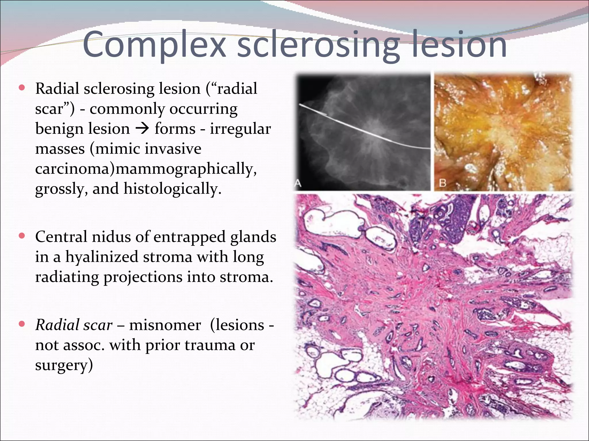 Breast benign disorders pathology | PPT