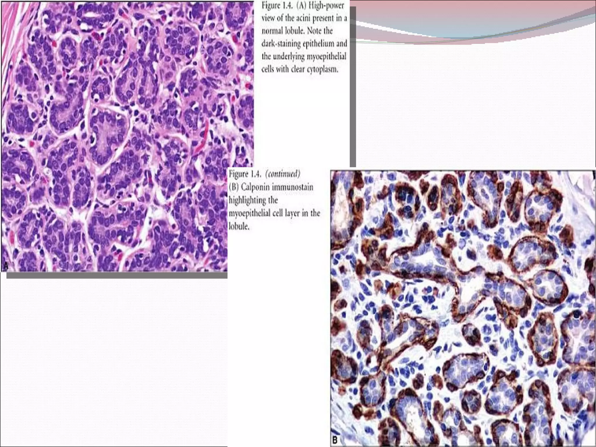 Breast benign disorders pathology | PPT