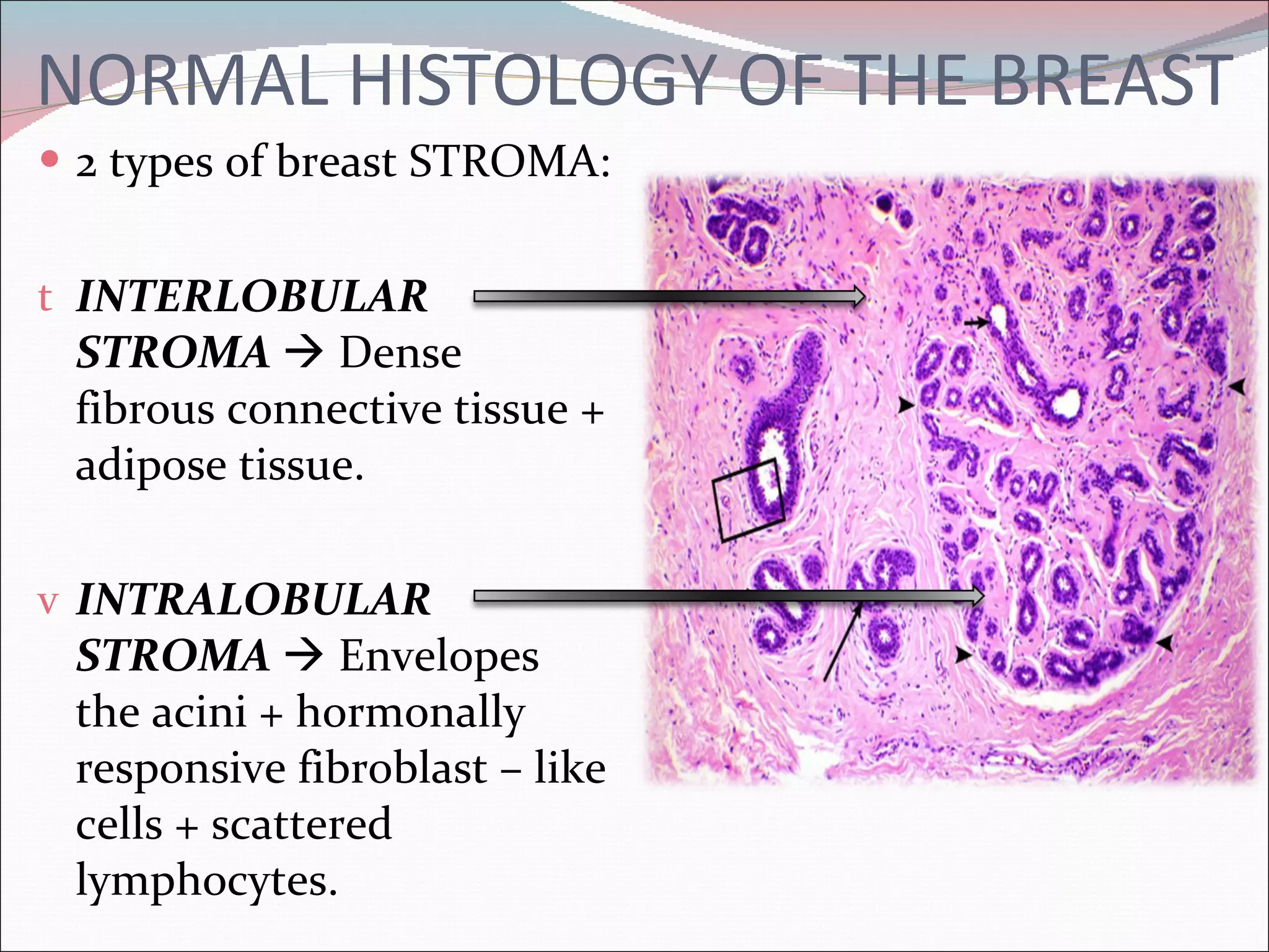Breast benign disorders pathology | PPT