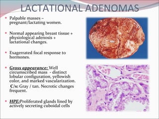 Breast benign disorders pathology | PPT