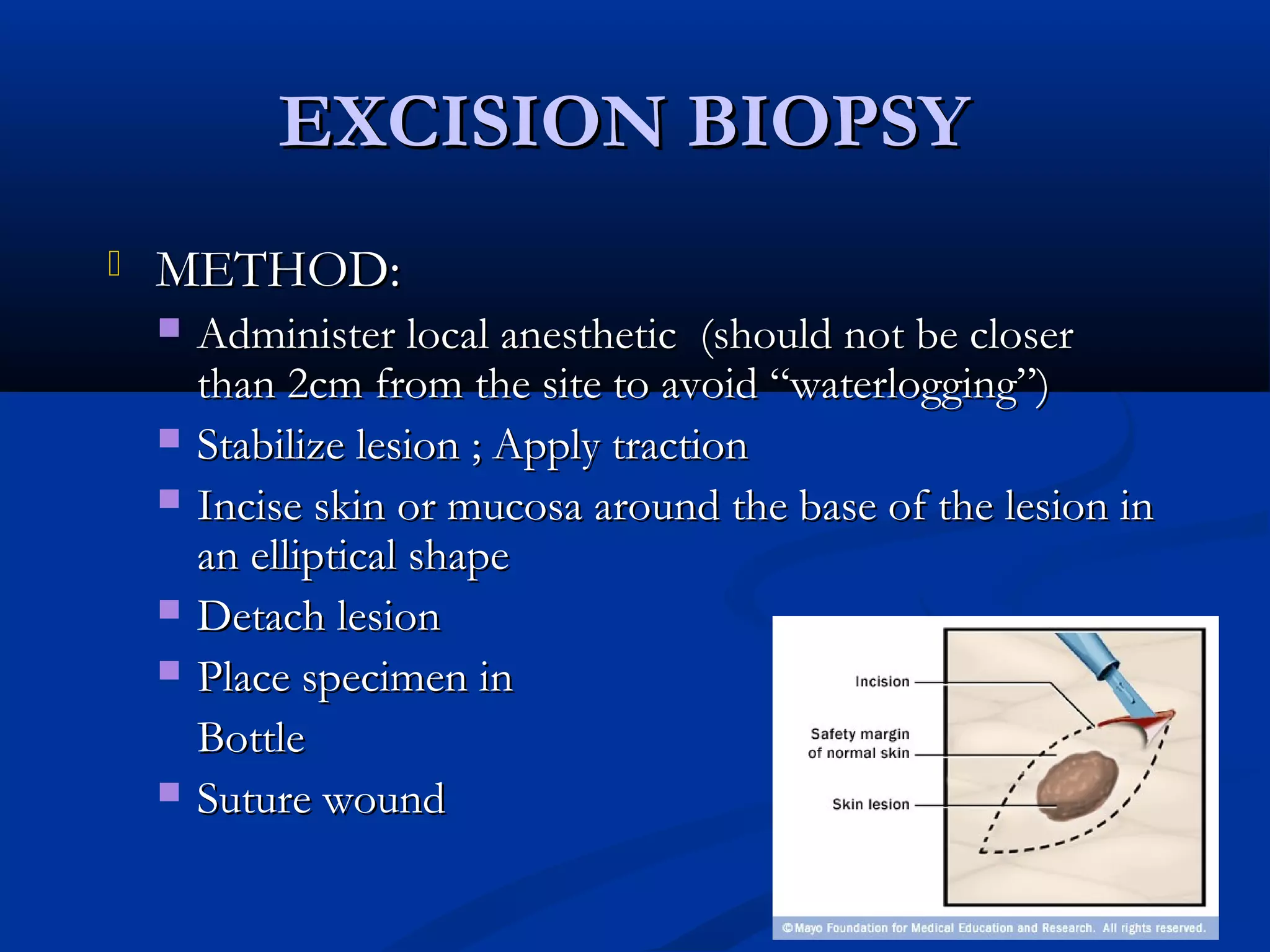 Breast biopsy ppt | PPT