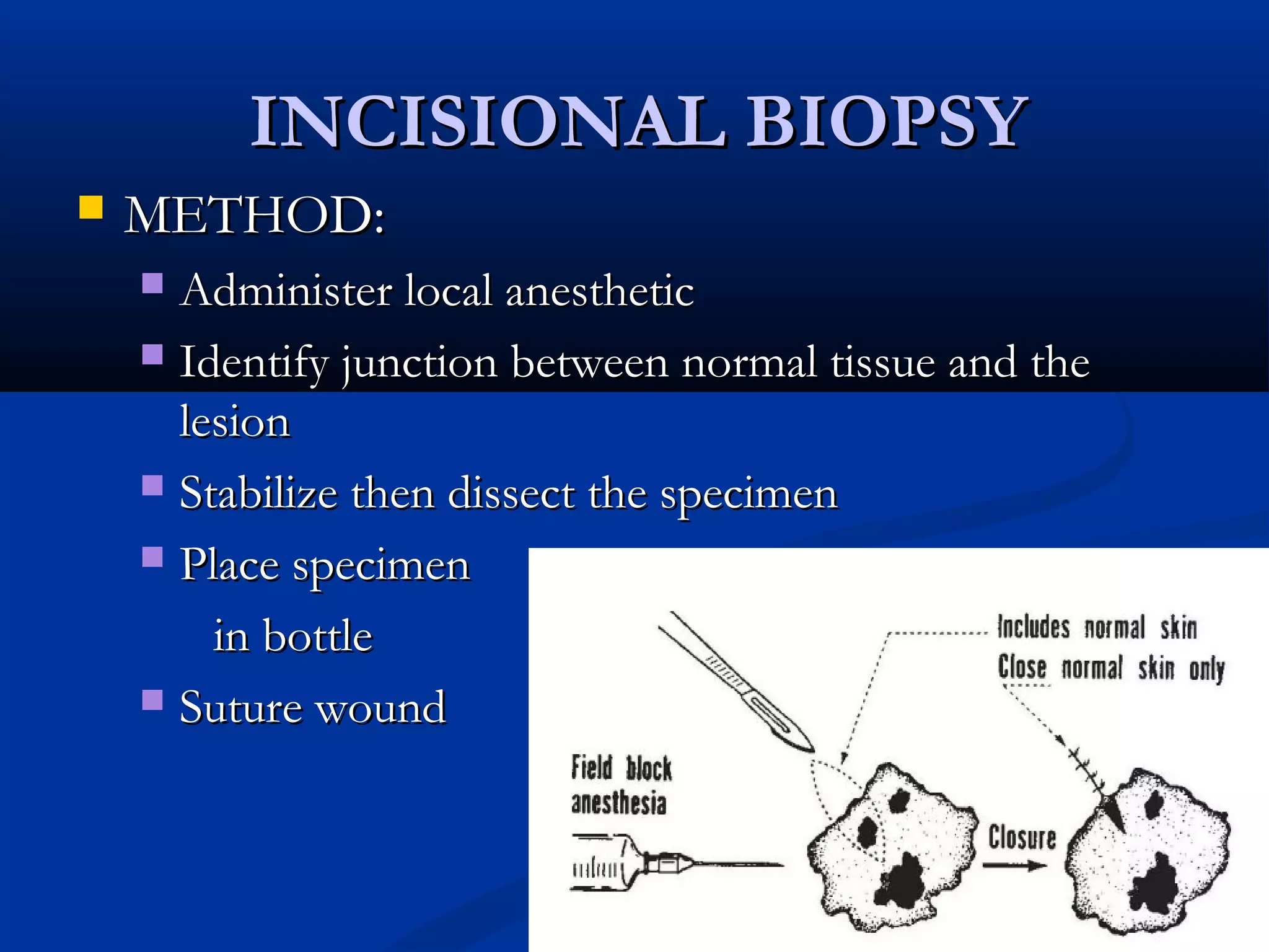 Breast biopsy ppt | PPT