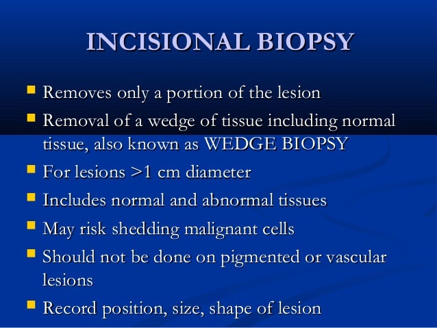 Breast Biopsy Ppt