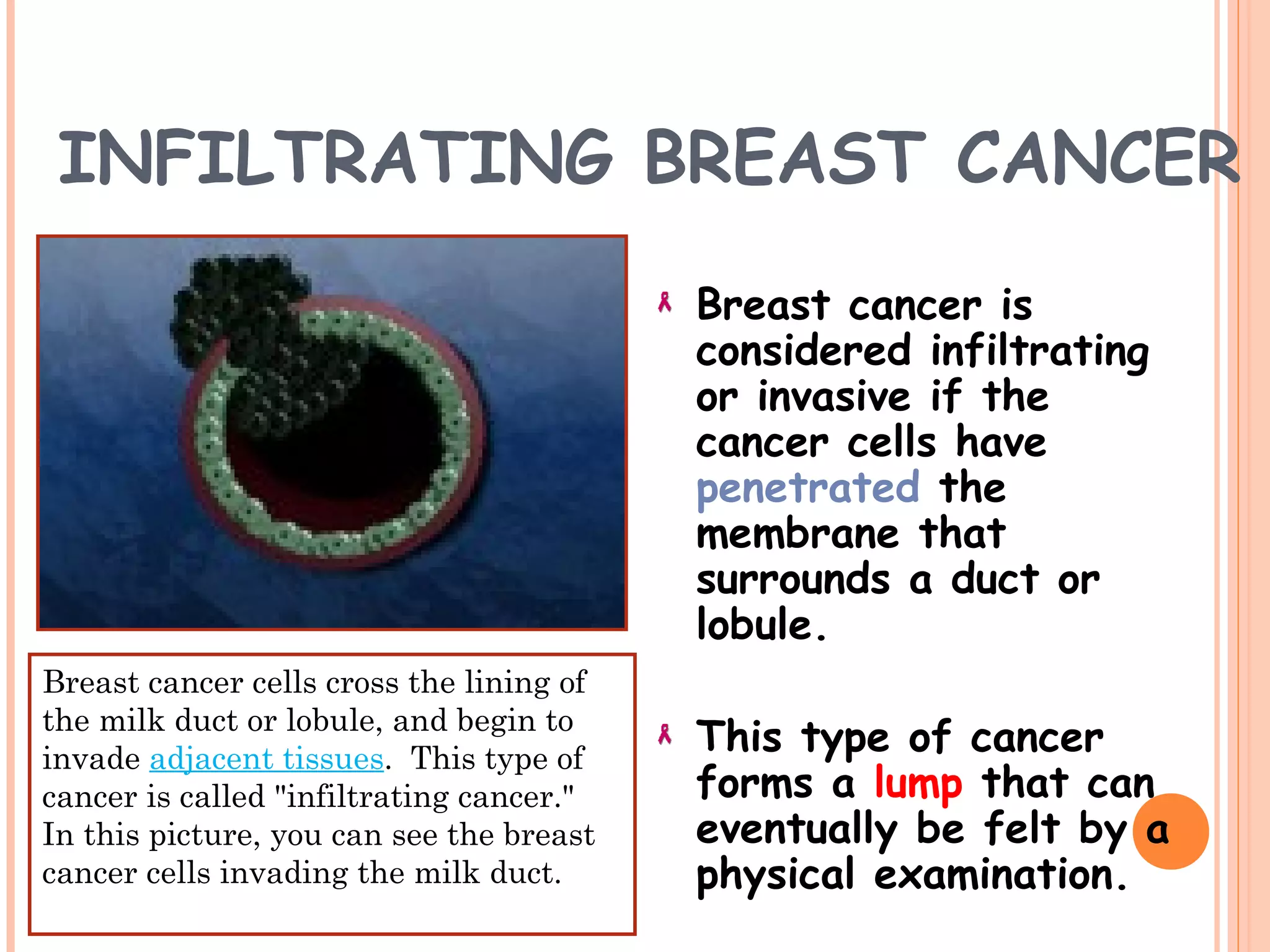 Breast CA by Dr. Celine Tey | PPT
