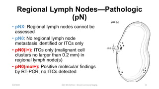 Breast Carcinoma Staging | PPTX