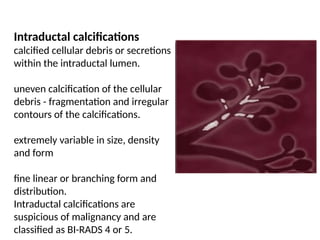 BREAST CALCIFICATIONS and related findigns.pptx