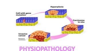 Breast cancer Case Study | PPTX