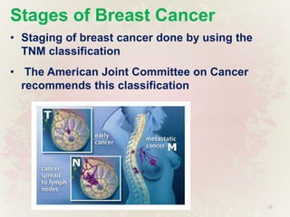 Breast cancer | PPTX