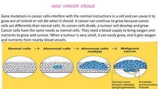 Breast cancer | PPTX