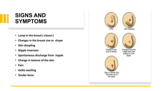 Breast cancer | PPTX