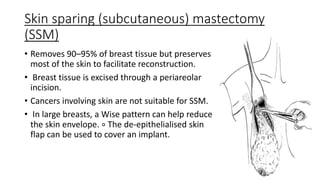 breast cancer.pptx