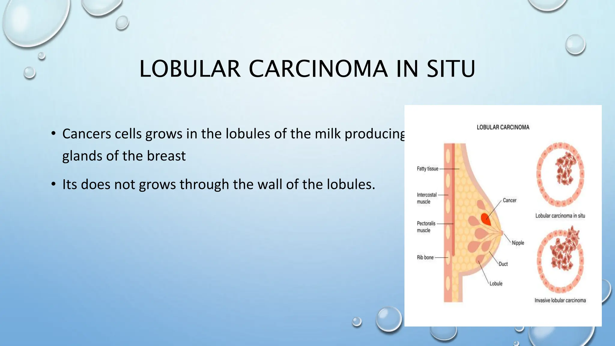 Breast cancer -ONCO IN MEDICAL AND SURGICAL NURSING.pptx