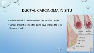 Breast cancer -ONCO IN MEDICAL AND SURGICAL NURSING.pptx
