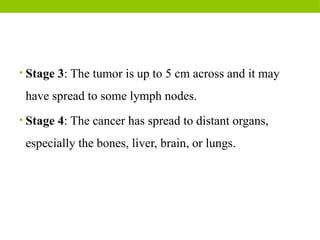 breast cancer definition,cause signs and symptoms,mgt | PPTX