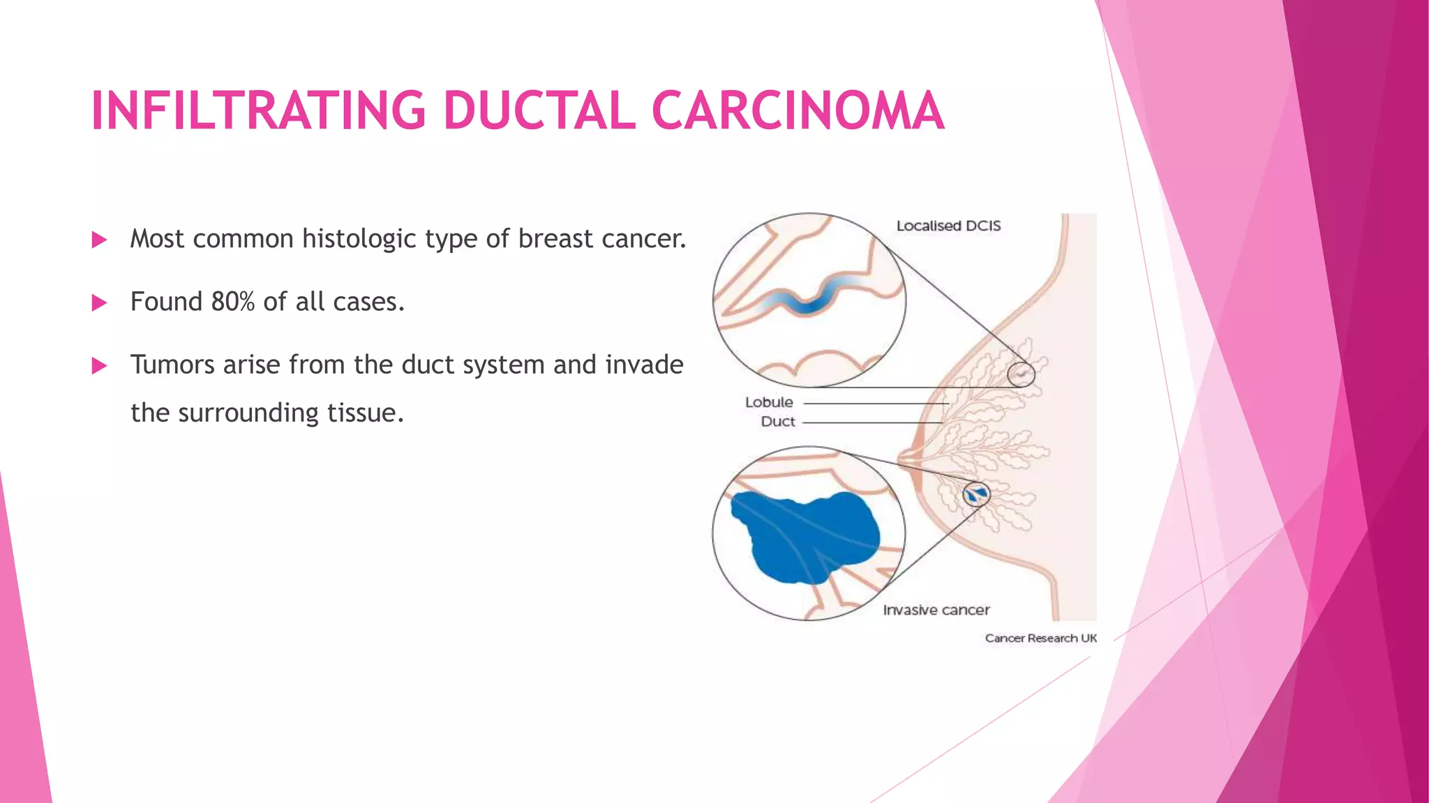 BREAST CANCER_074427.pptx