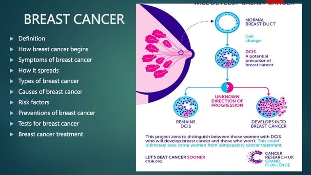 Breast Cancer | PPTX