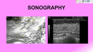 breast cancer awareness lecture.screening and prevention | PPTX