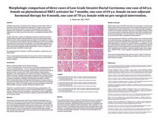 Protandim and Breast Cancer Cells Study | PPT
