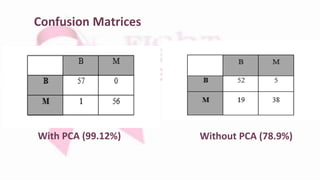 Breast cancer classification | PPTX