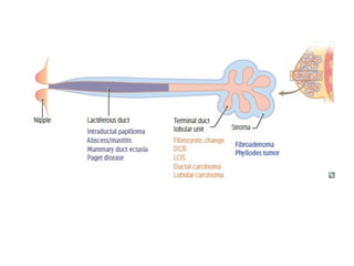 Breast cancer types, prognosis, classification | PPTX