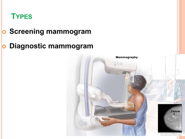 Breast cancer ppt | PPTX