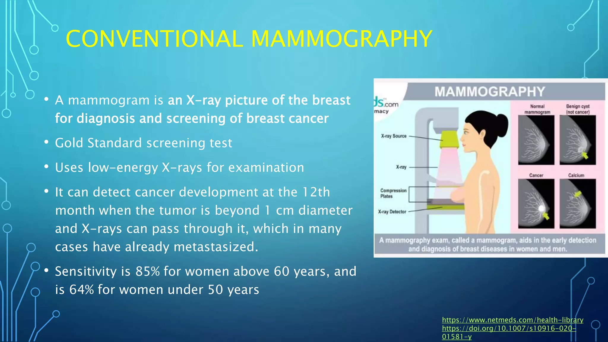 Overview of breast cancer screening and diagnosis | PPTX