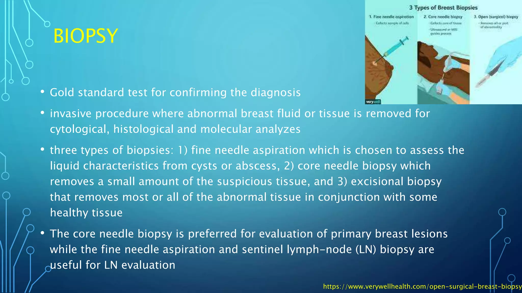 Overview of breast cancer screening and diagnosis | PPTX