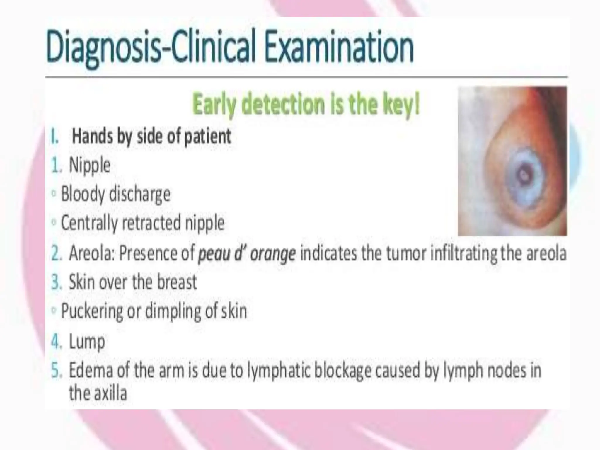 Breast cancer: A very detailed analysis. | PPT