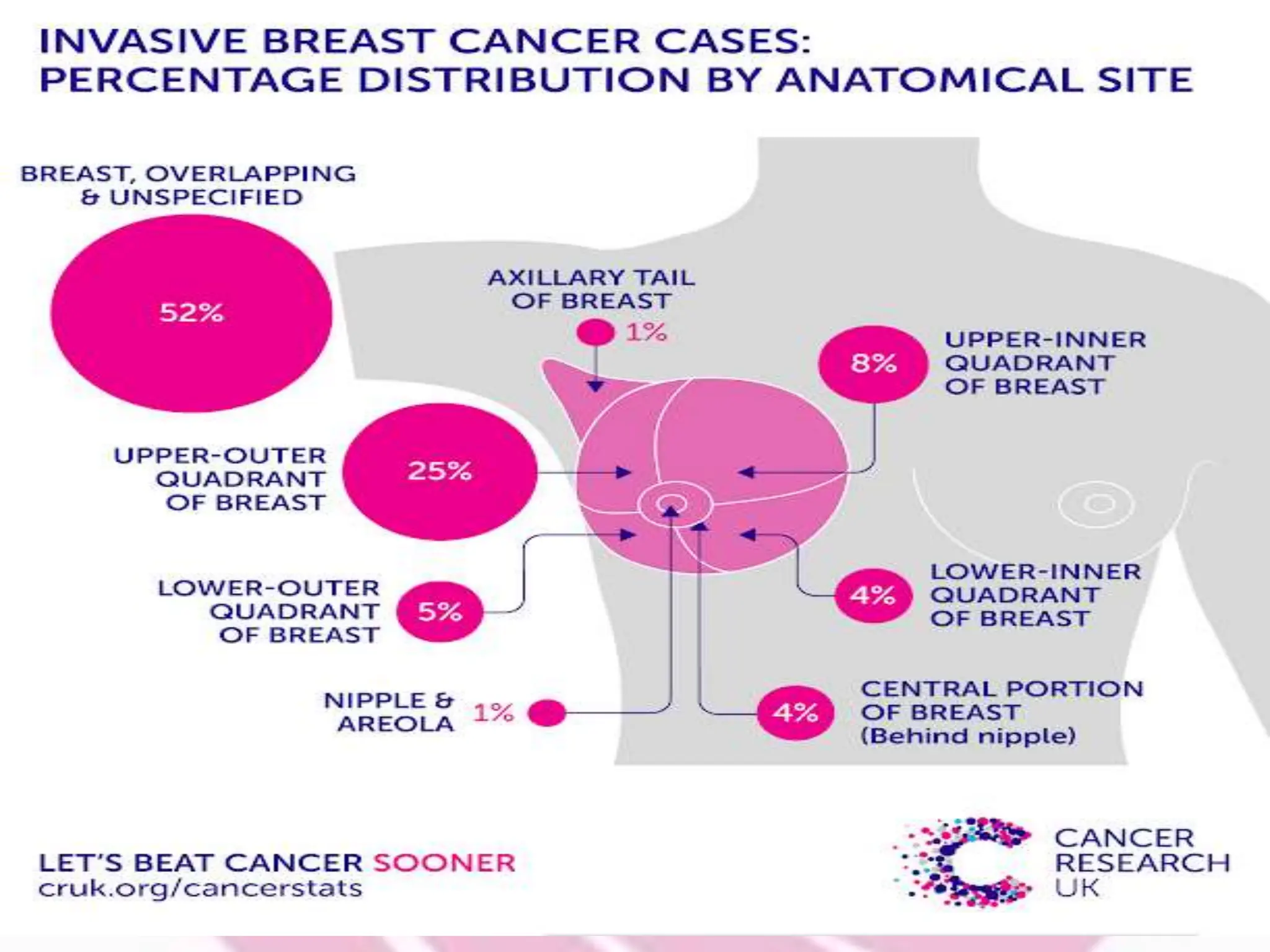 Breast cancer: A very detailed analysis. | PPT