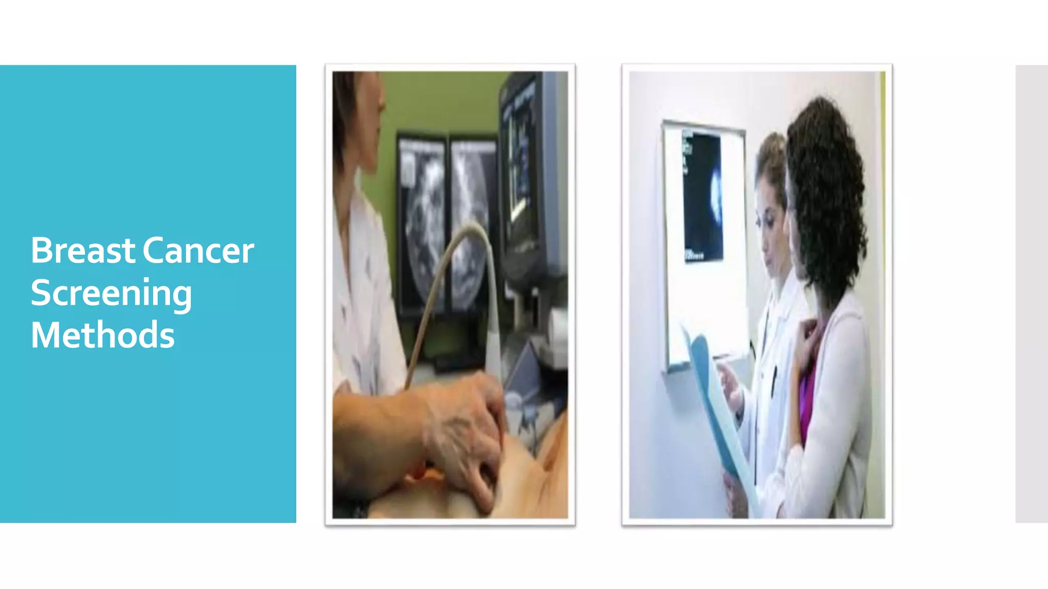 Breast cancer screening | PPTX