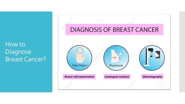 Breast cancer screening | PPTX
