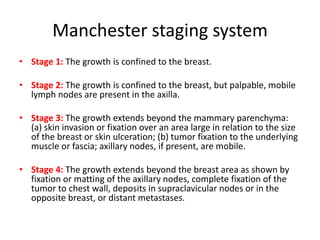 Breast cancer staging | PPTX