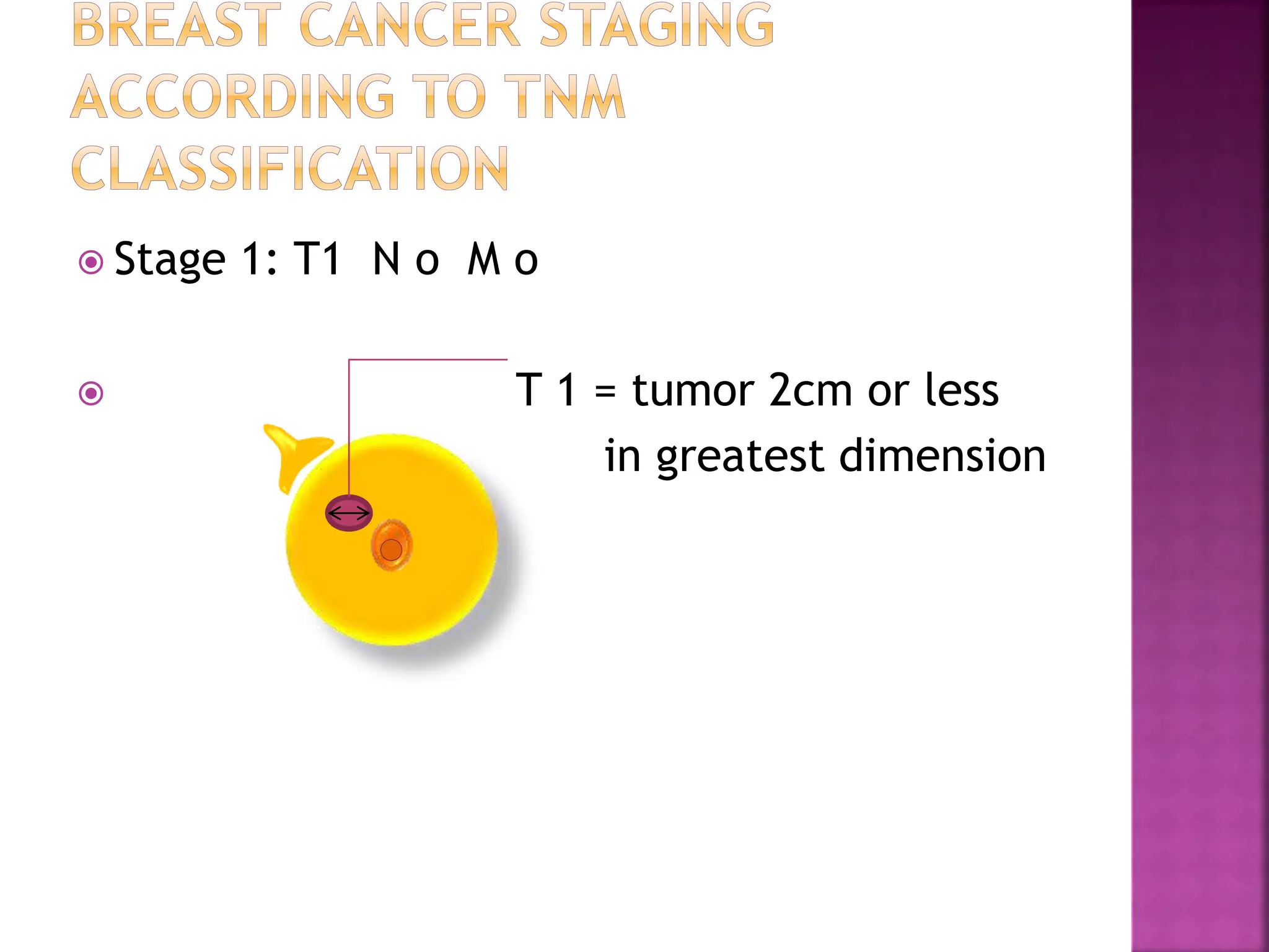 BREAST CANCER STAGING.ppt