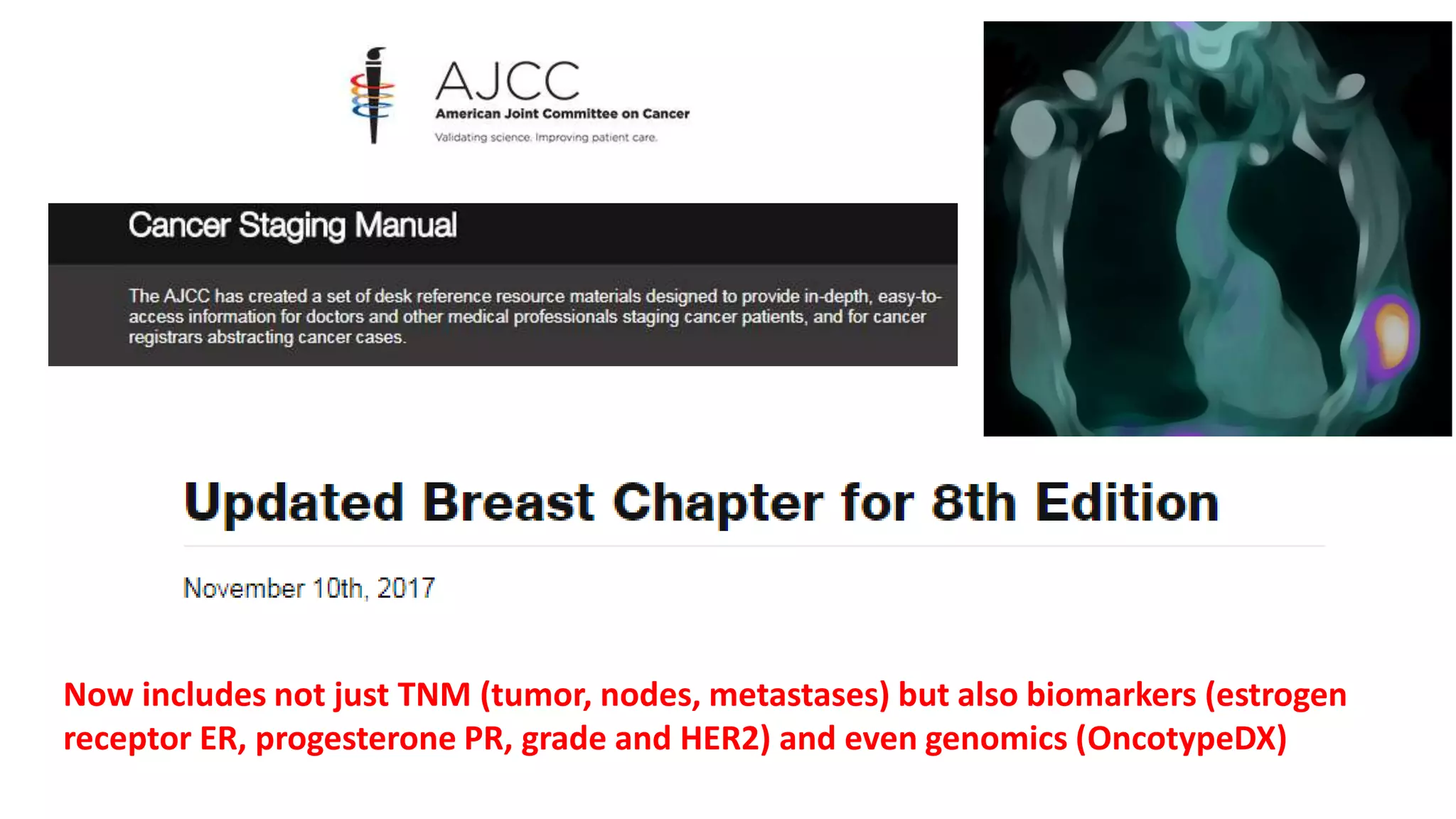 Breast cancer staging 2018 video power points | PPT