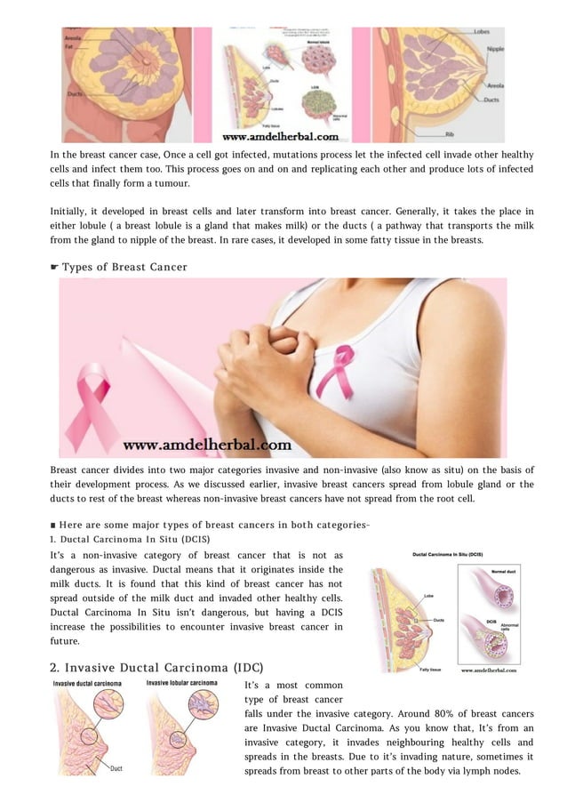 Breast cancer types causes | PDF